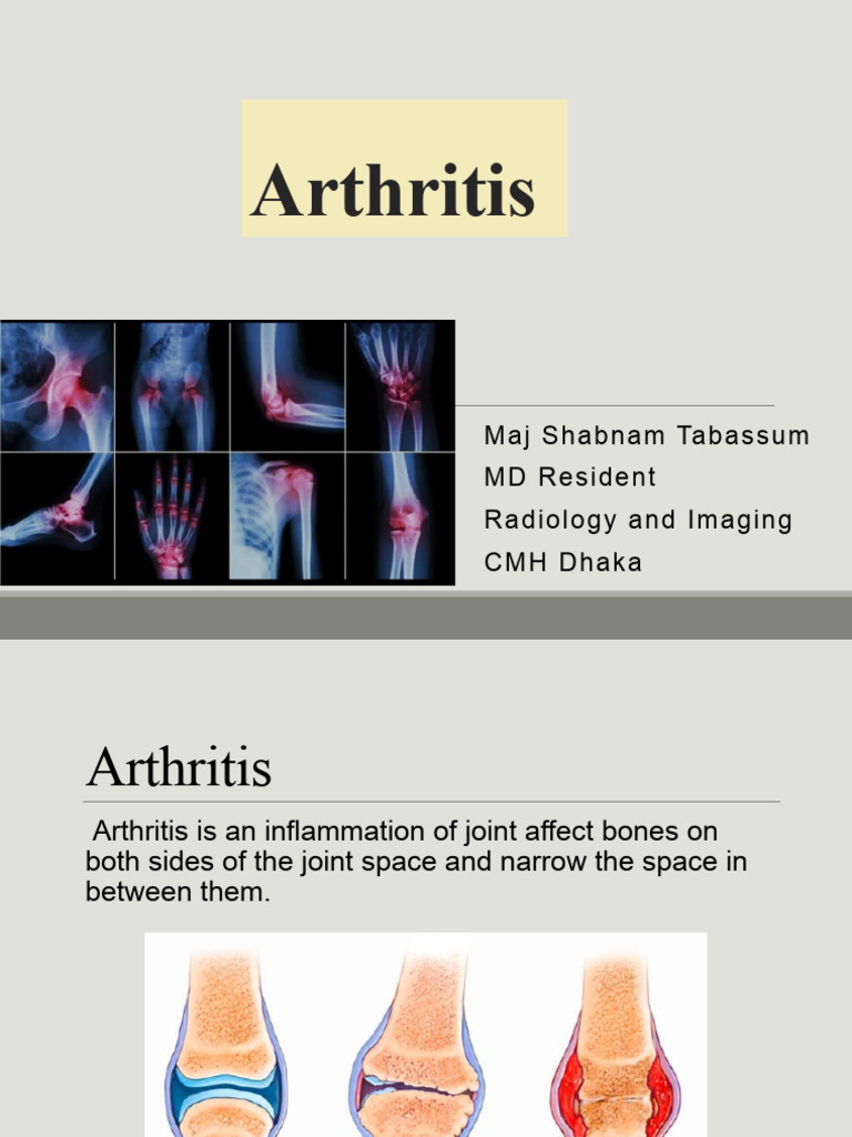 Imaging of Arthritis | PDF | Osteoarthritis | Vertebral Column