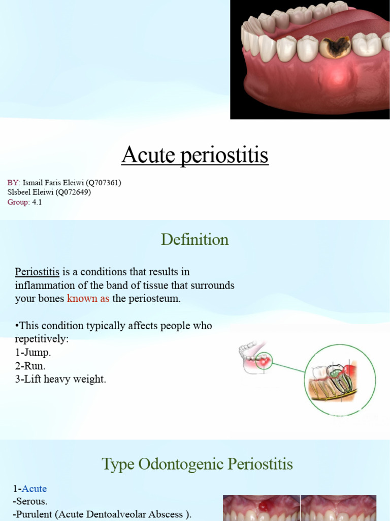 Acute Periostitis Presentation 2 | PDF | Bone | Tooth