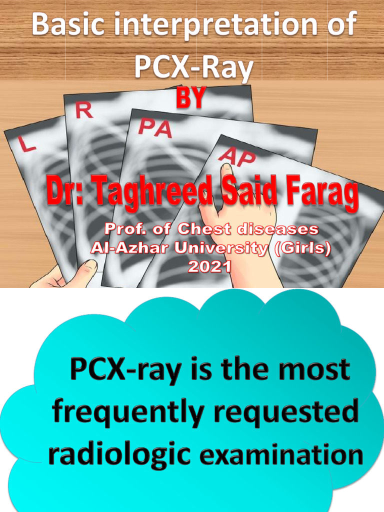 Chest X-Ray Interpretation Guide | PDF | Lung | Heart