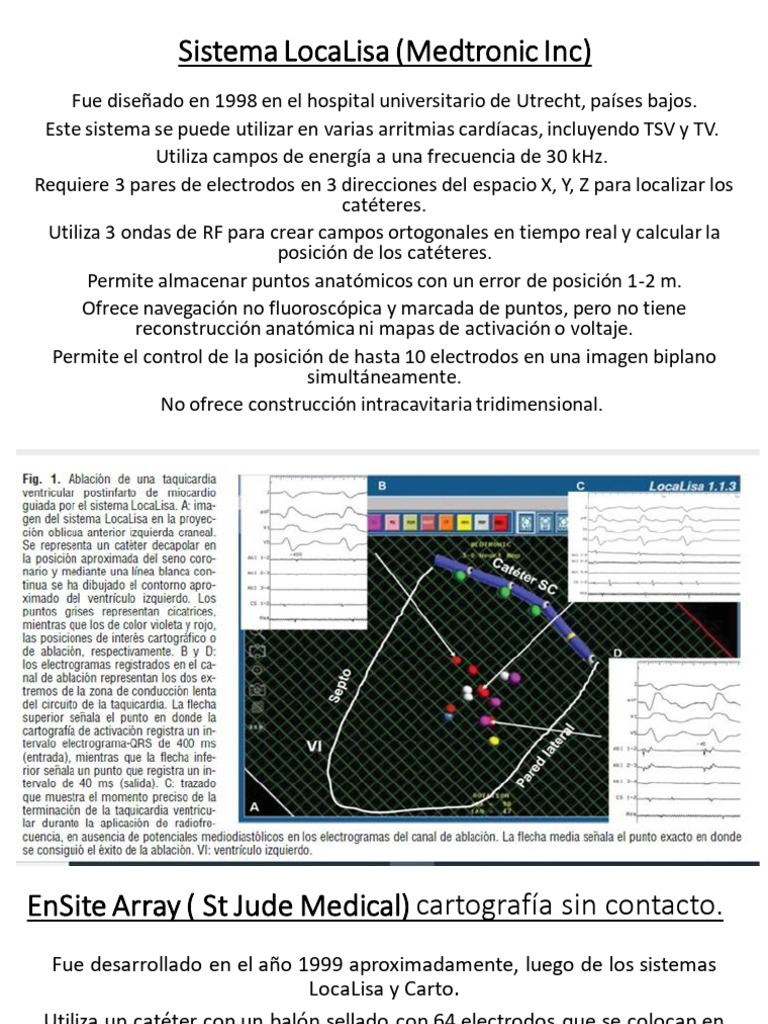 Sistema EnSite NavX, EnSite Array y LocaLisa | PDF ...