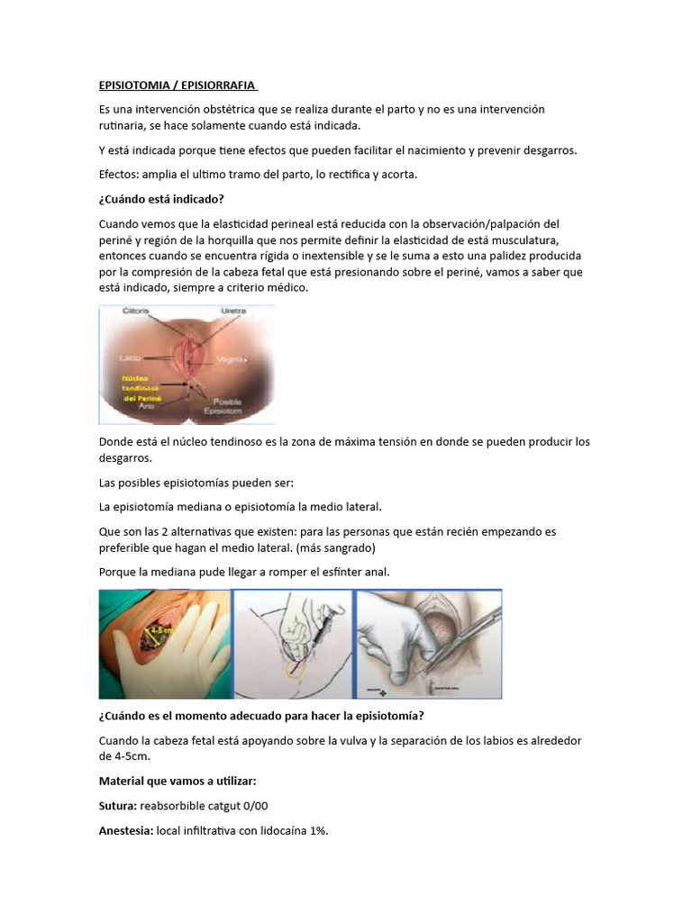 EPISIOTOMIA | PDF