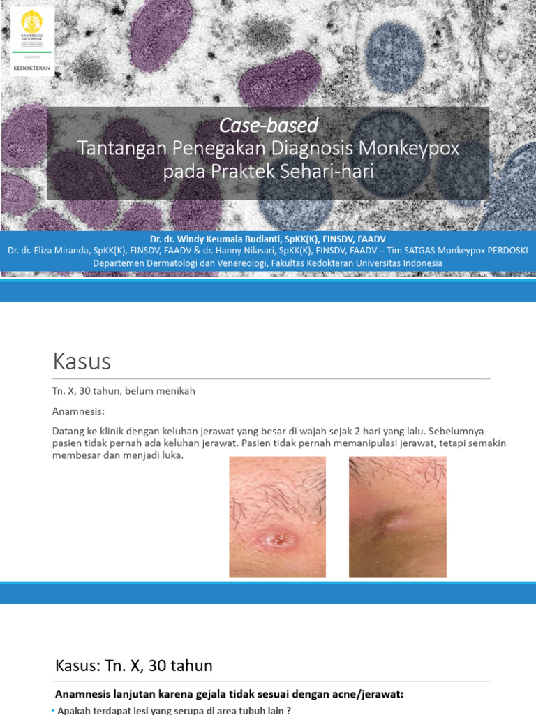 Tantangan Diagnosis Monkeypox | PDF