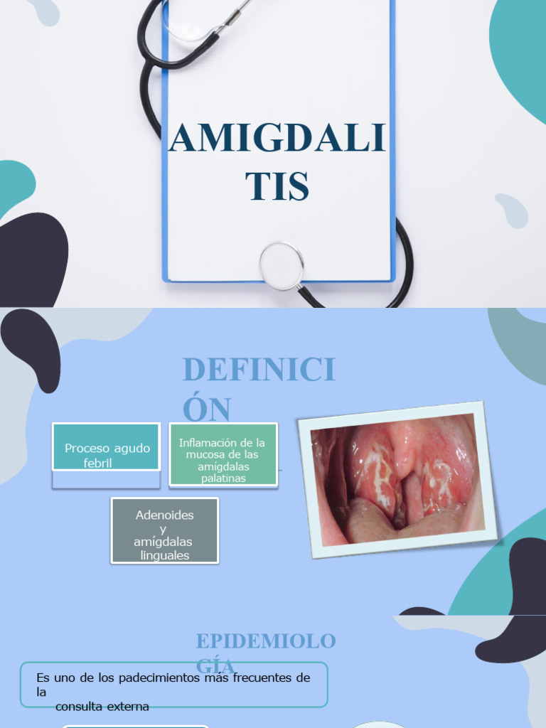Amigdalitis: Viral vs Bacteriana | PDF | Medicina | Causas de la muerte