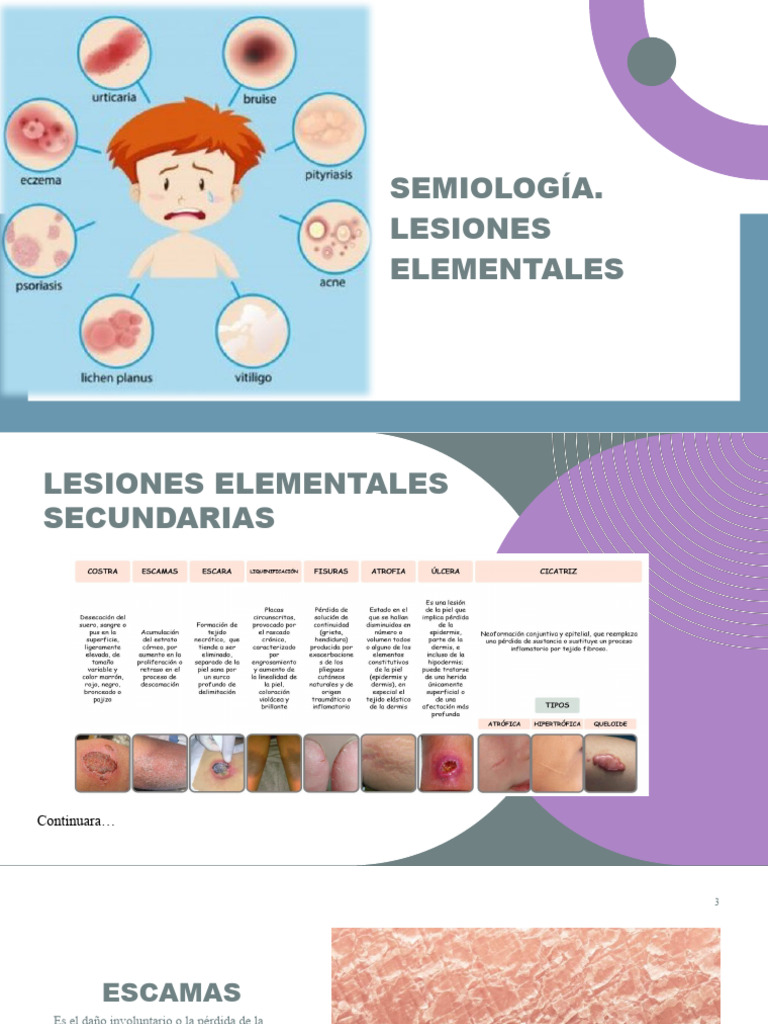 Lesiones Elementales en Dermatología | PDF | Piel | Medicina CLINICA