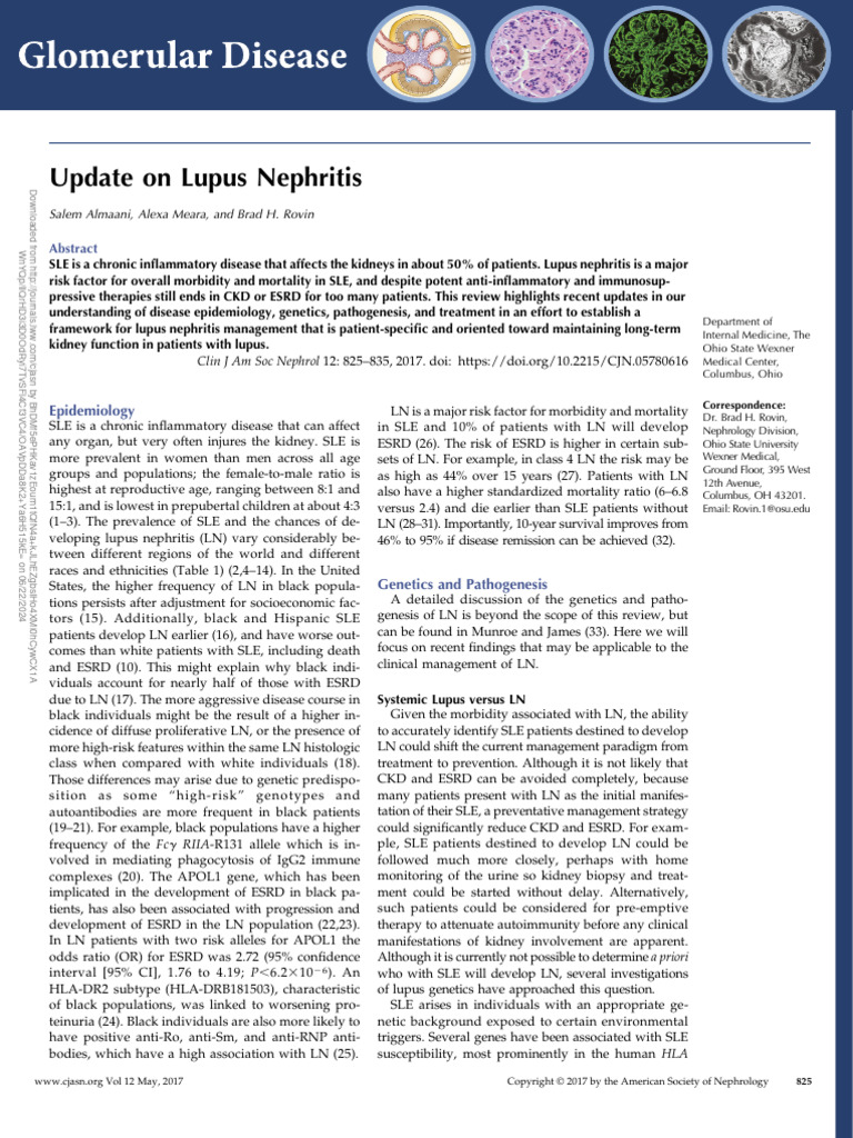 Update On Lupus Nephritis.16 | PDF | Kidney | T Cell