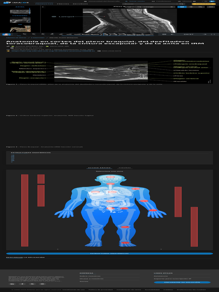 IRM Del Plexo Braquial Anatomía Normal E-Anatomy | PDF