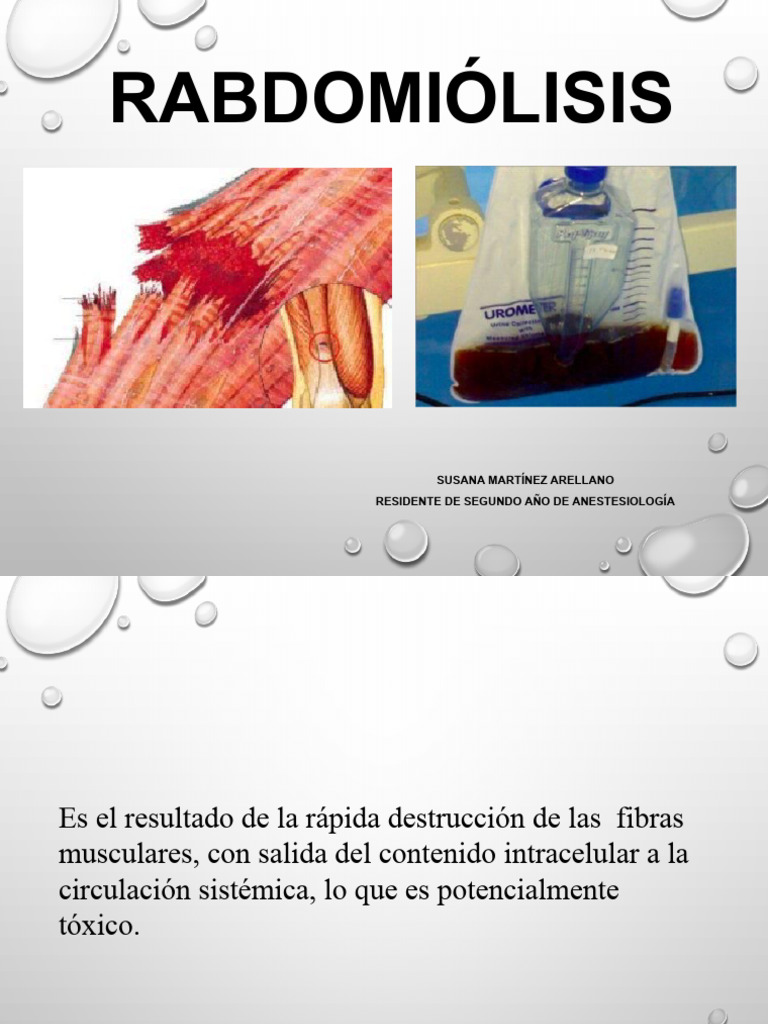 Rabdomiólisis: Causas y Tratamiento | PDF | Medicina CLINICA ...