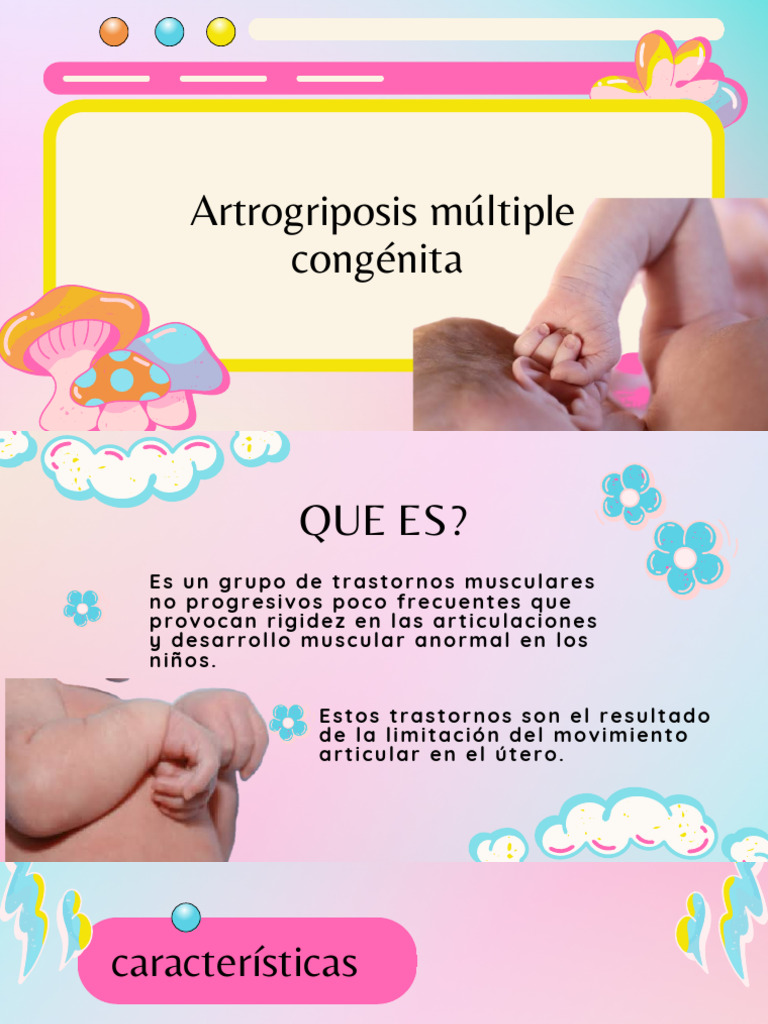 Artrogriposis Multiple Congenita | PDF | Salud y bienestar