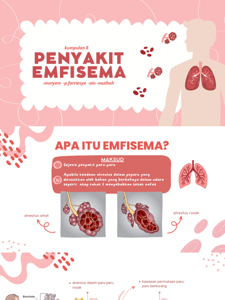 Penyakit Emfisema | PDF