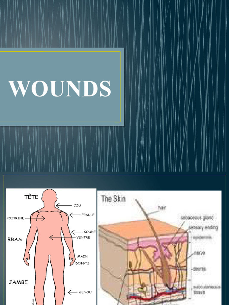 Wounds | PDF | Wound | Wound Healing