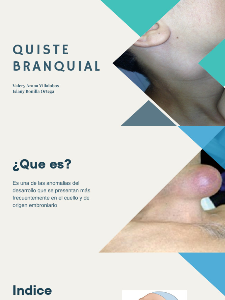 Quiste Branquial | PDF | Nervio vago | Anatomía