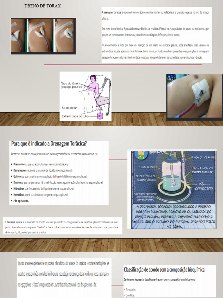 Aula Dreno Torax Pratica | PDF | Veia | Enfermagem