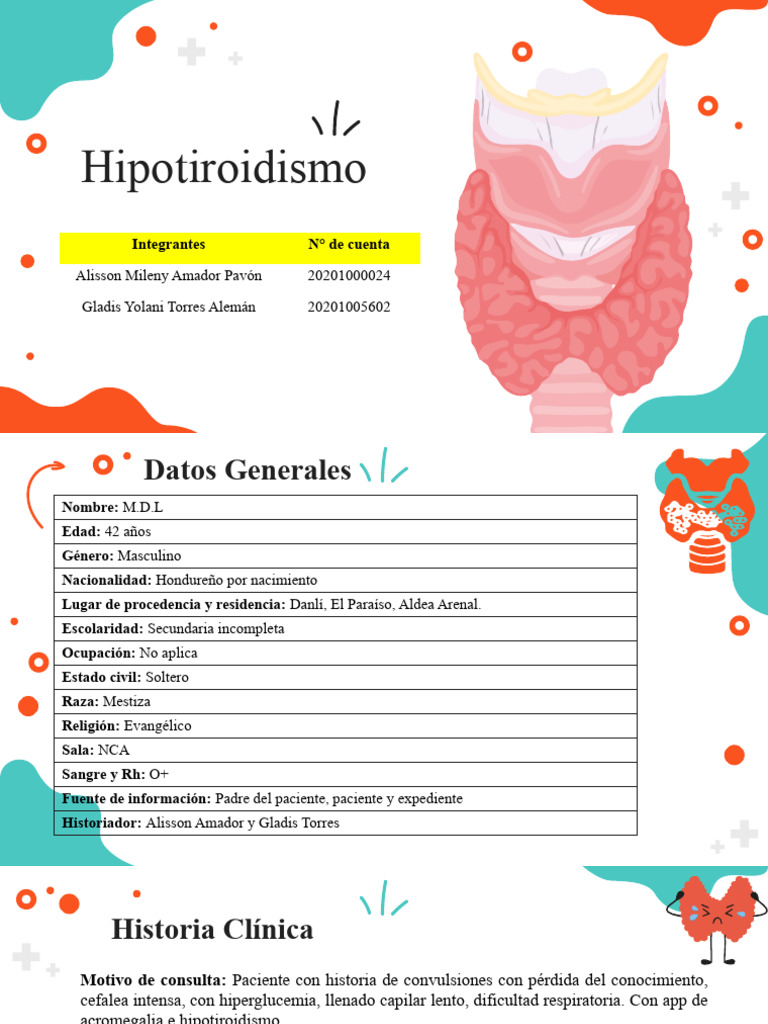 Caso Clinico Hipotiroidismo | PDF