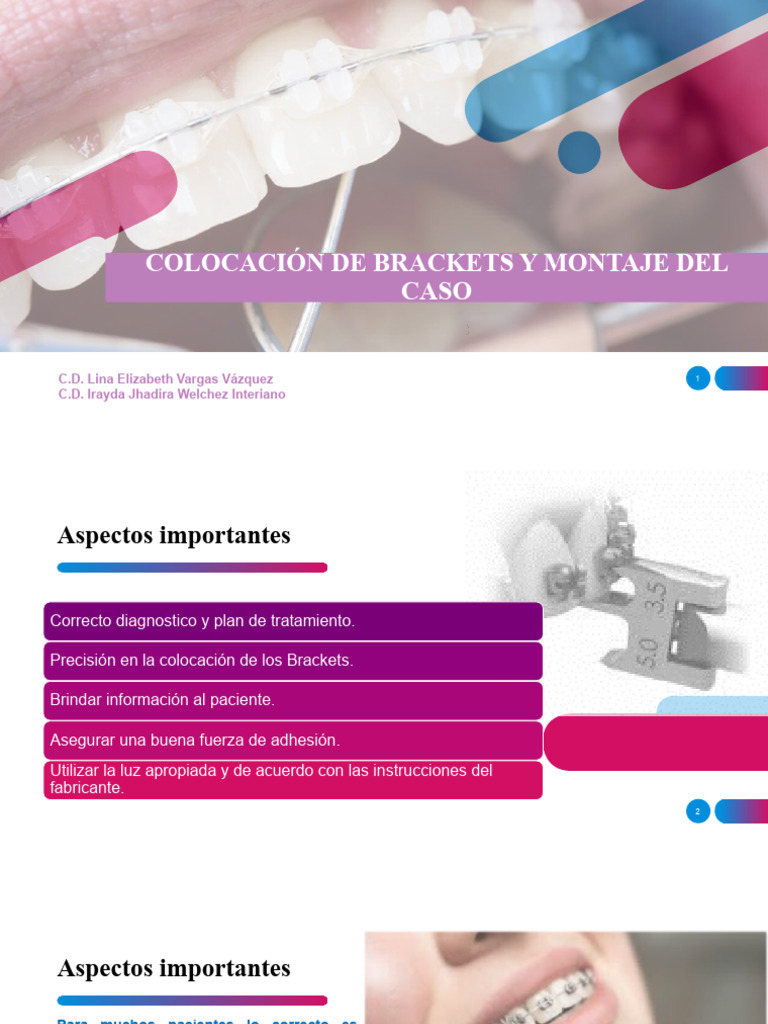 Colocación de Brackets y Montaje Del Caso.cap3 Mbt | Descargar gratis ...