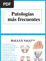 Anatomía de la Arteria Pedia del Pie | PDF | Pie | Dedo del pie
