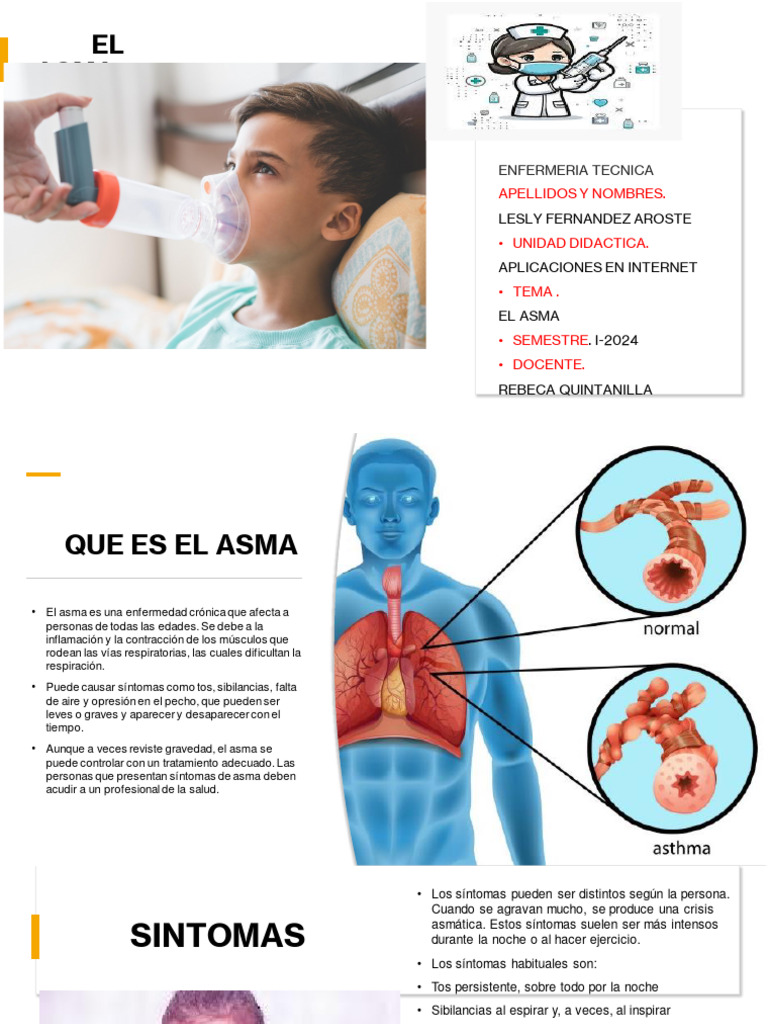 Presentación 4 | PDF | Asma | Alergia