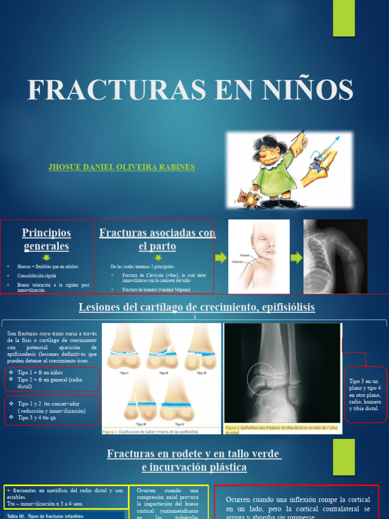 FRACTURAS EN NIÑOS | PDF | Anatomía | Sistema esquelético