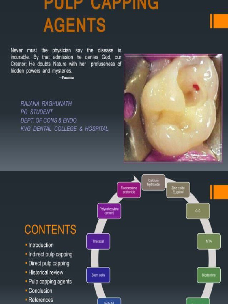 Pulp Capping Agents | PDF