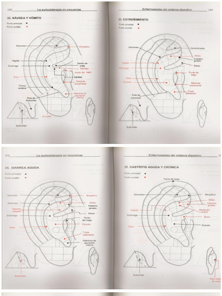 La Auriculoterapia en Esquemas 2 | PDF