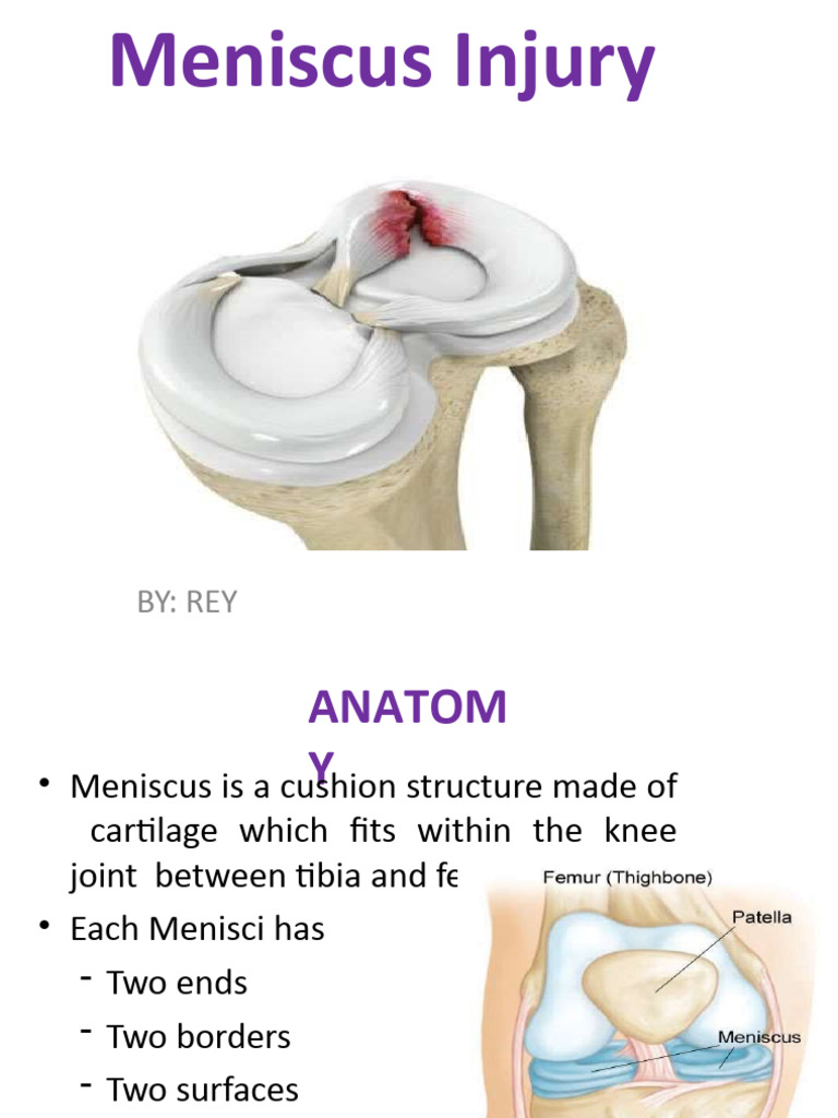 meniscus-injury rey | PDF | Knee | Lower Limb Anatomy