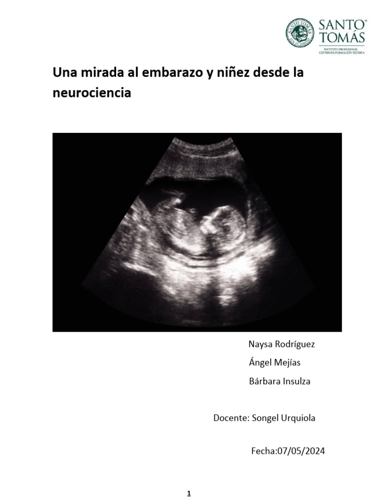 Emba Razo | PDF | Espectro autista | Aprendizaje