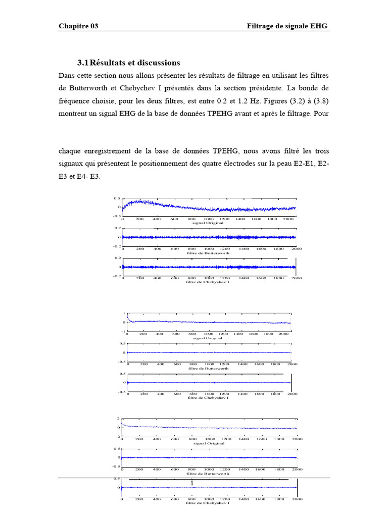 Filtrage des signaux EHG : Butterworth et Chebyshev | PDF | Rapport ...