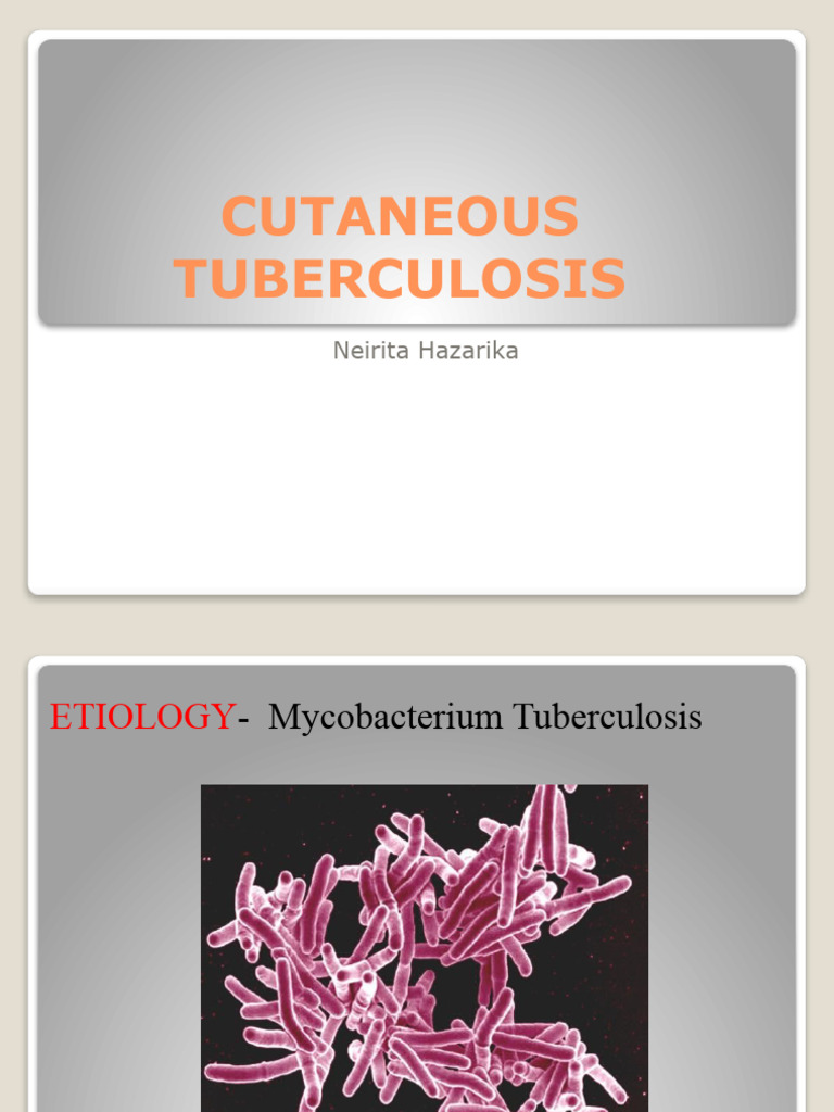 Cutaneous Tuberculosis | PDF | Tuberculosis | Medical Specialties