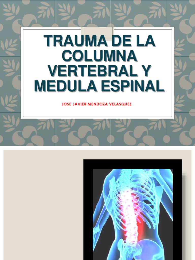 Trauma Medular | Descargar gratis PDF | Médula espinal | Neurología