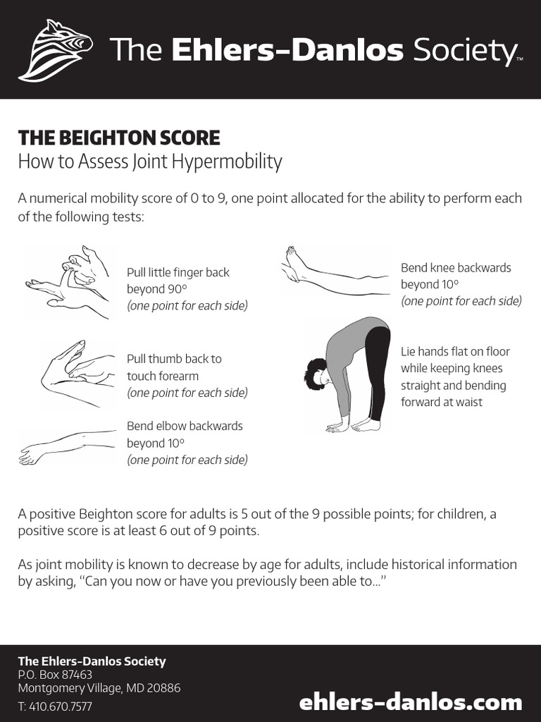Beighton Score 2017 | PDF