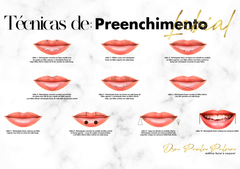 Técnicas de Preenchimento Labial A4(2) | PDF | Anatomia humana | Rosto