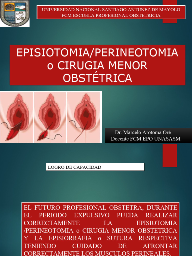 EPISIOTOMIA Clas 7 | PDF | Parto | Especialidades Medicas