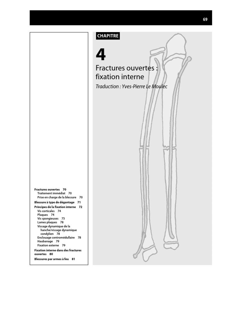 Chapitre 4 Fractures Ouvertes Fixation in 2010 Prise en Charge Des ...