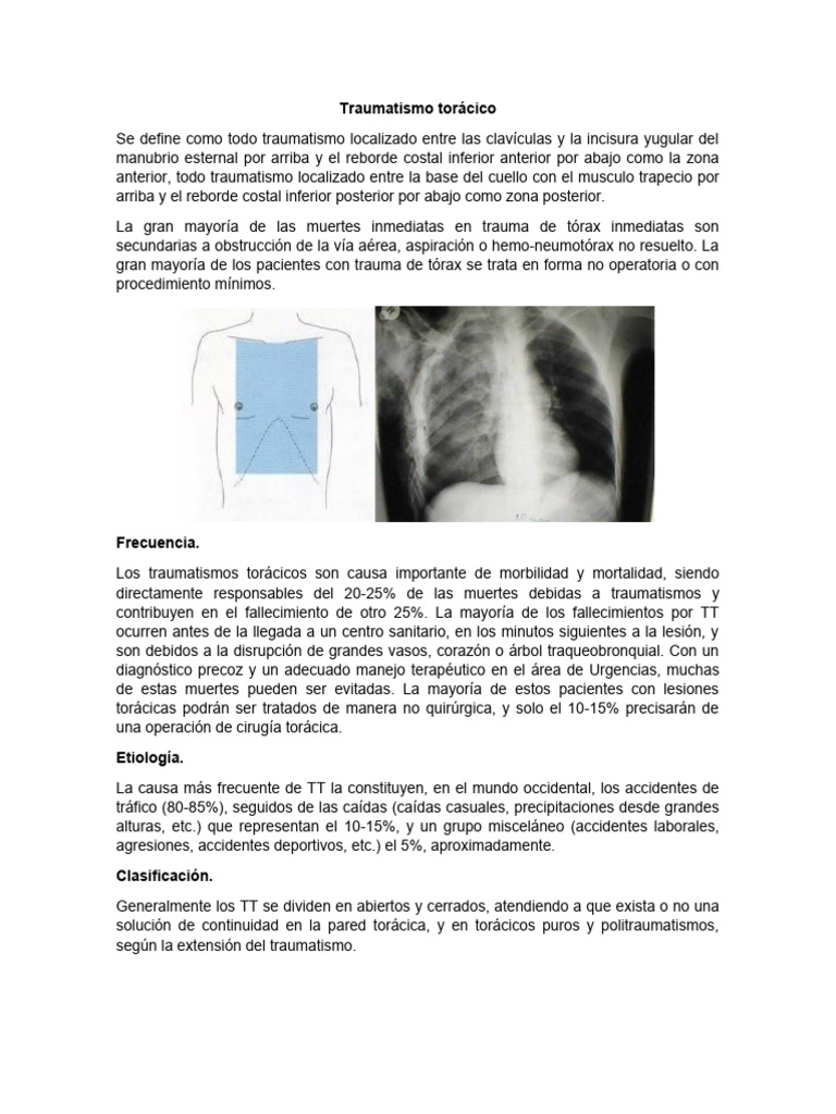 Traumatismo Torácico | PDF | Tórax | Enfermedades y trastornos
