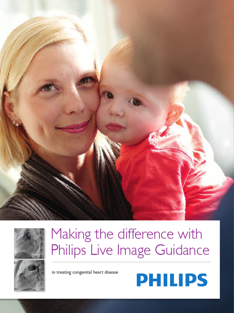 Philips Allura Xper FD1010 Cath Lab Machine | PDF | Ct Scan | X Ray