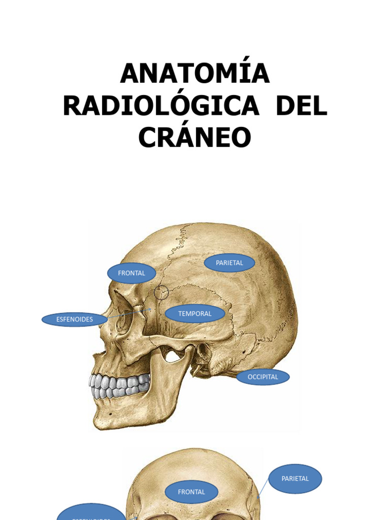 Anatomia radiologica de craneo (1) | Descargar gratis PDF ...