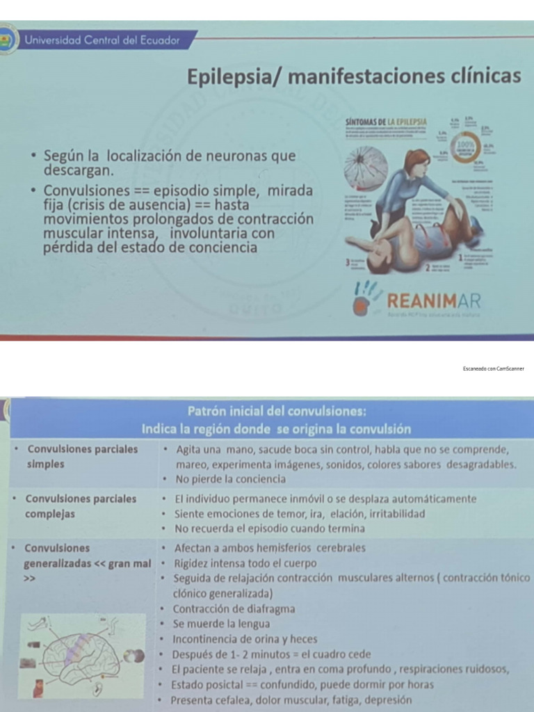 Epilepsia | PDF