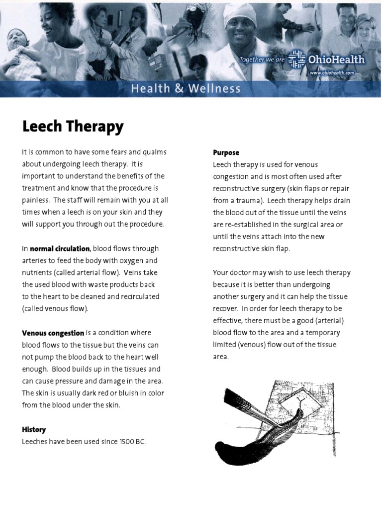 Leech Therapy | PDF | Vein | Circulatory System