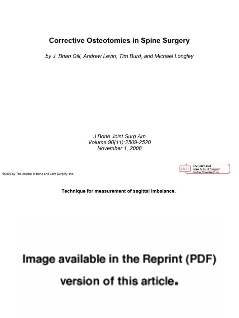 Corrective Osteotomies in Spine Surgery: by J. Brian Gill, Andrew Levin ...