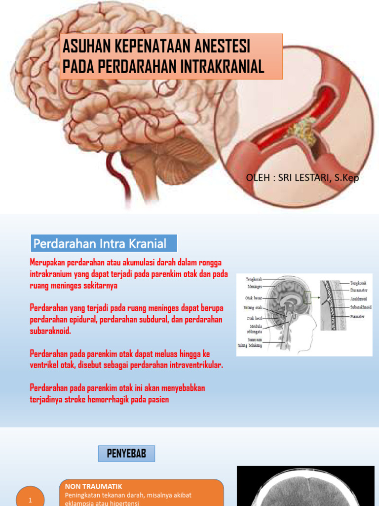 Askan Perdarahan Intrakranial 2024 | PDF