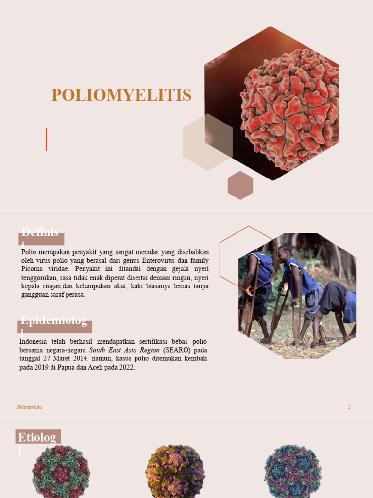 Poliomyelitis | PDF