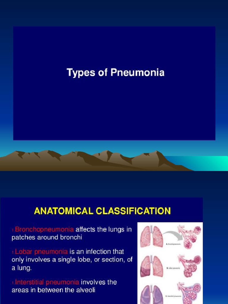 -Types of Pneumonia-2021 - Копия 2 | PDF