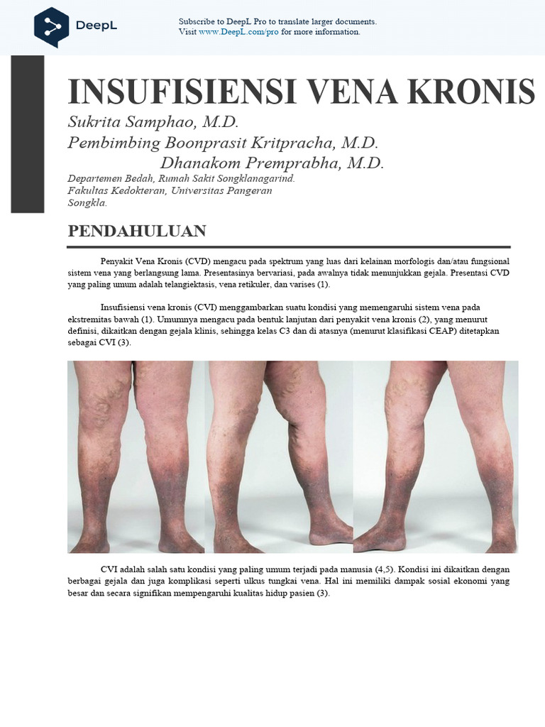 Insufisiensi Vena Kronis: Gejala dan Anatomi | PDF