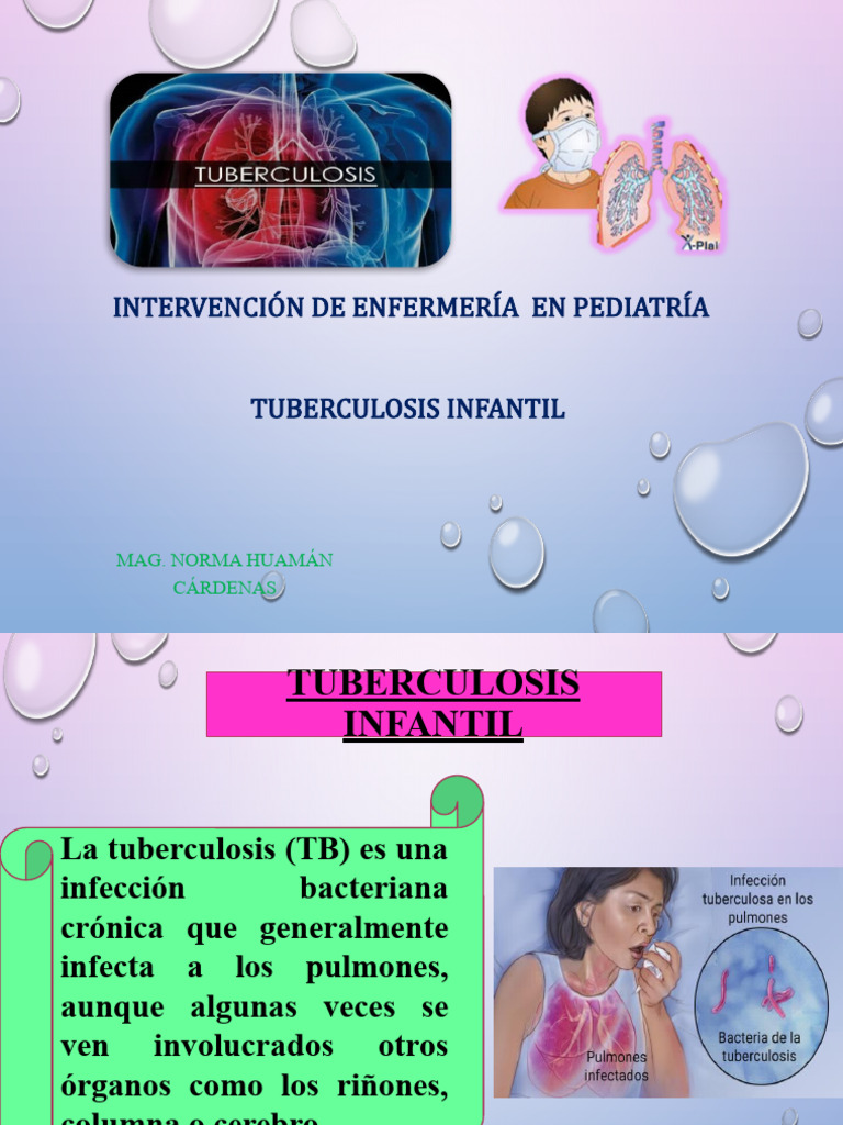 9 Tuberculosis Infantil | PDF | Tuberculosis | Nutrición