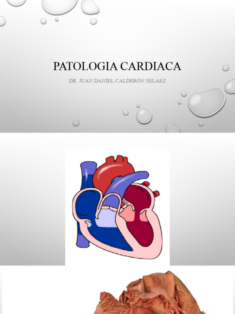 PATOLOGIA CARDIACA | PDF | Corazón | Causas de la muerte