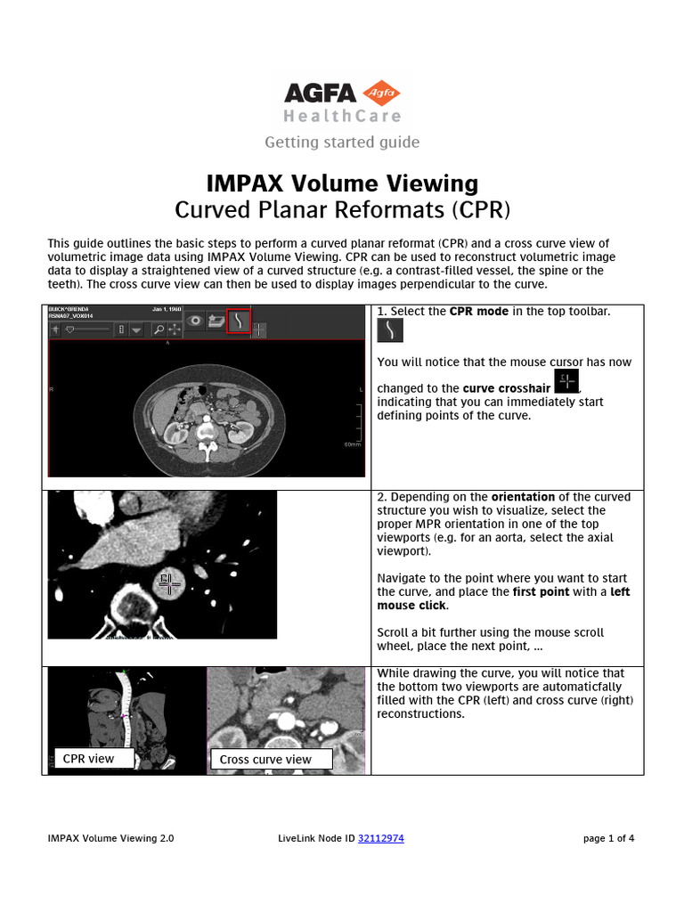 IMPAX Volume Viewing 2.0 - Curved Planar Reformat | PDF | Software ...