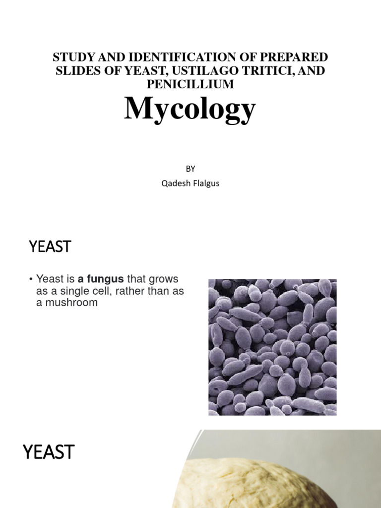 Study and Identification of Prepared Slides of Fungi | PDF | Fungus | Yeast