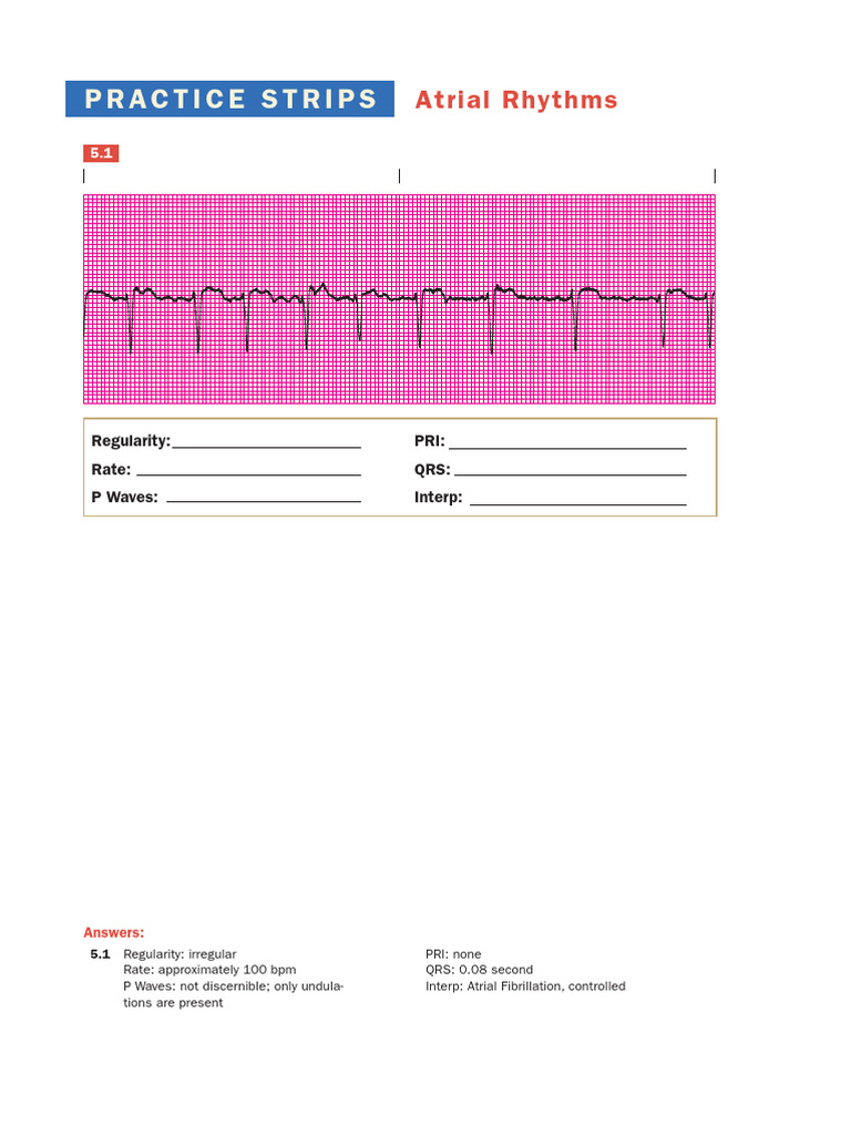 EKG Atrial Rhythm | PDF