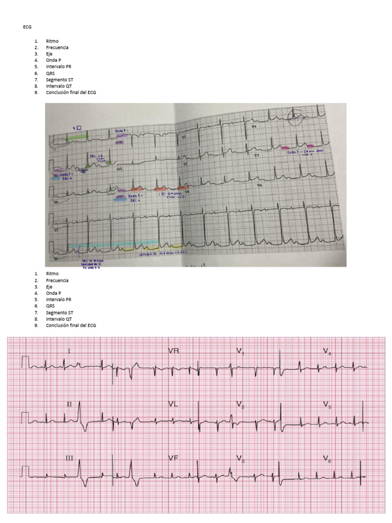 Practicas para ECG | PDF