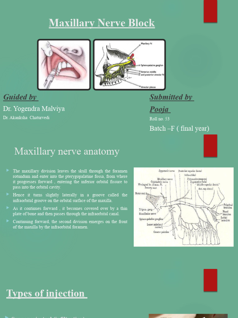 Maxillary Nerve Block | PDF | Anesthesia | Injection (Medicine)
