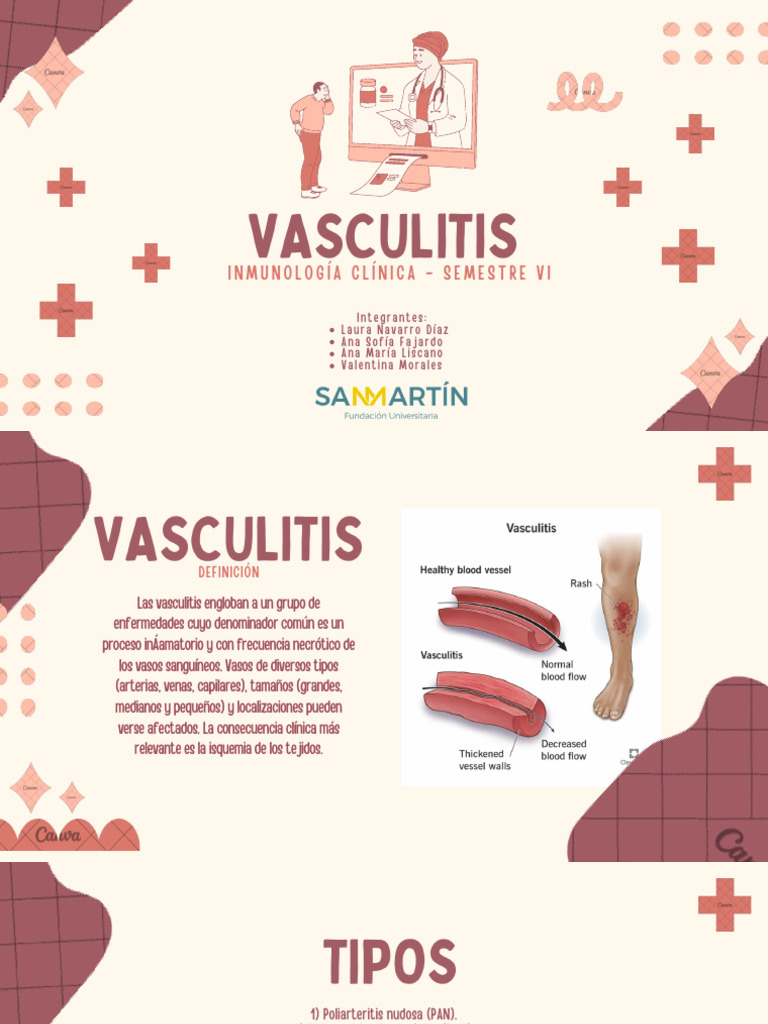 Vasculitis | PDF | Inflamación | Causas de la muerte